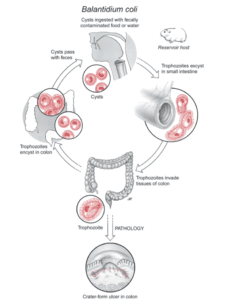 Understanding Balantidium coli: Classification, Morphology, Diagnosis ...